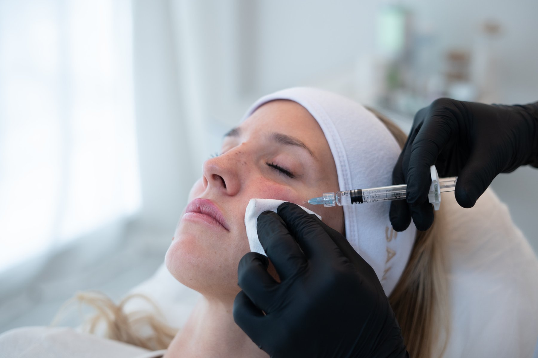 Periocular Mesotherapy for Eye Rejuvenation